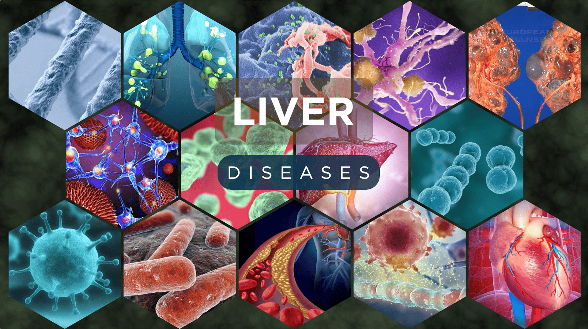 Liver Diseases Explained – Causes, Symptoms, & Treatments | European ...