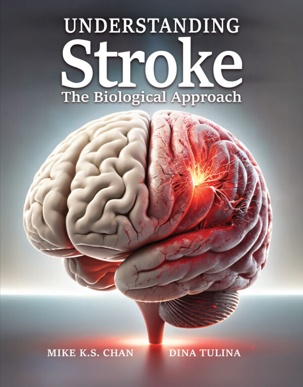 Understanding Stroke - The Biological Approach | European Wellness