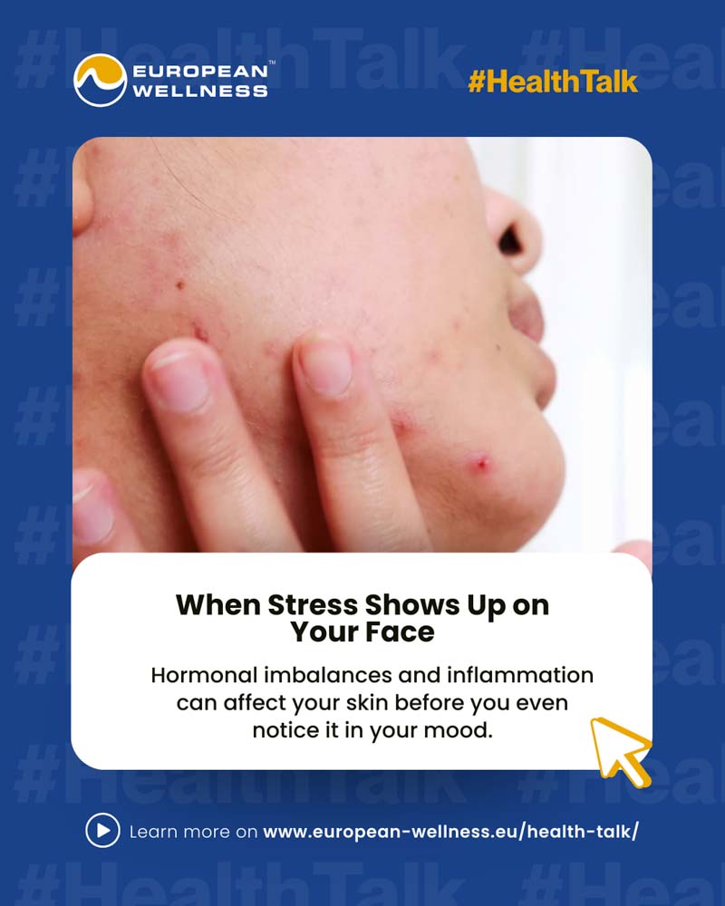 Stress & Skin – The Unseen Connection | European Wellness
